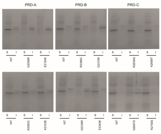 Missense Mutations in Desmoplakin Plakin Repeat Domains Have Dramatic ...