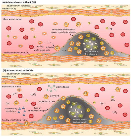 Impact of Uremic Toxins on Endothelial Dysfunction in Chronic Kidney ...