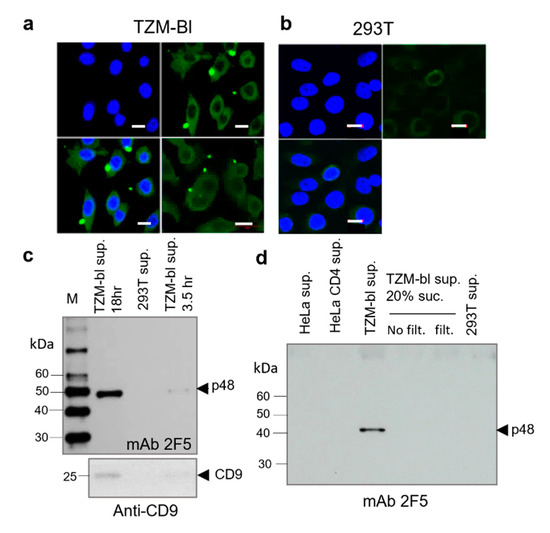 The TZM-bl Reporter Cell Line Expresses Kynureninase That Can ...