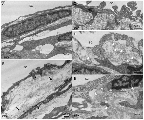 Relationships between Intraocular Pressure, Effective Filtration Area ...