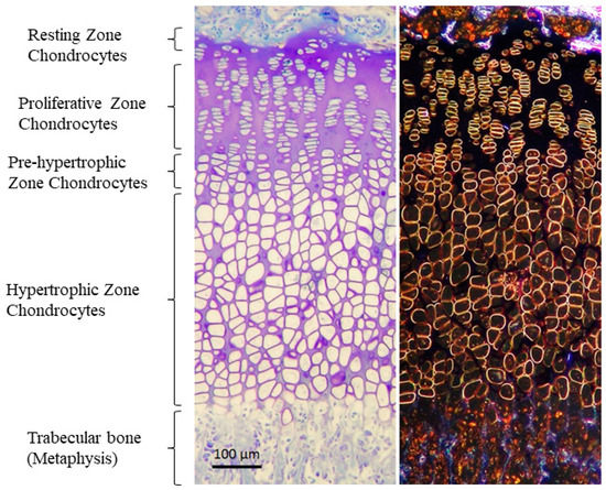 Endochondral Ossification Zones