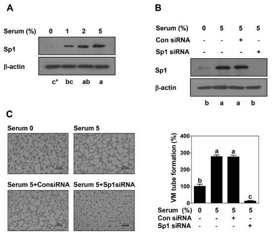 Sp1 Plays a Key Role in Vasculogenic Mimicry of Human Prostate Cancer Cells