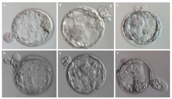 Cellular and Molecular Nature of Fragmentation of Human Embryos