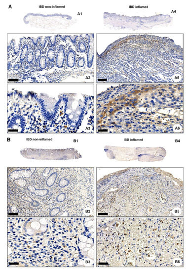 pH-Sensing G Protein-Coupled Receptor OGR1 (GPR68) Expression and ...