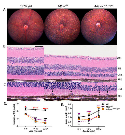 Genetic Interaction between Mfrp and Adipor1 Mutations Affect Retinal ...