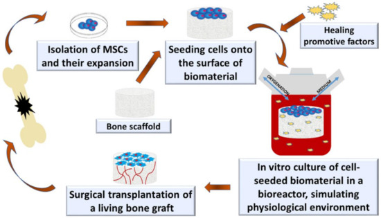 Bioengineered Living Bone Grafts—A Concise Review on Bioreactors and ...