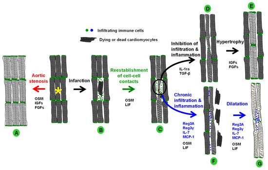 The Role of Oncostatin M and Its Receptor Complexes in Cardiomyocyte ...
