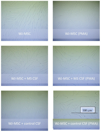 IJMS | Free Full-Text | Effect of Multiple Sclerosis Cerebrospinal ...