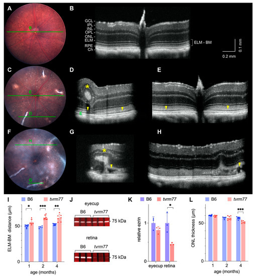 A Splicing Mutation in Slc4a5 Results in Retinal Detachment and Retinal ...