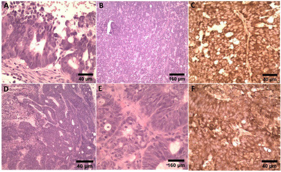 In Vivo Evaluation of Sgc8-c Aptamer as a Molecular Imaging Probe for ...