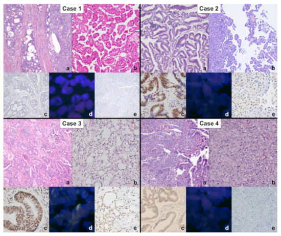 IJMS | Special Issue : Mesothelial Cell: Its Repair, Plasticity, and ...