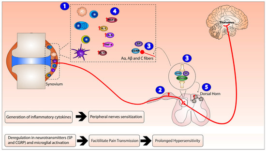 Heat Shock Proteins Alterations in Rheumatoid Arthritis