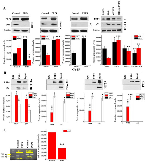PRP4 Induces Epithelial–Mesenchymal Transition and Drug Resistance in ...