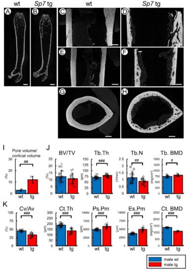 IJMS | Free Full-Text | Sp7 Transgenic Mice with a Markedly Impaired ...