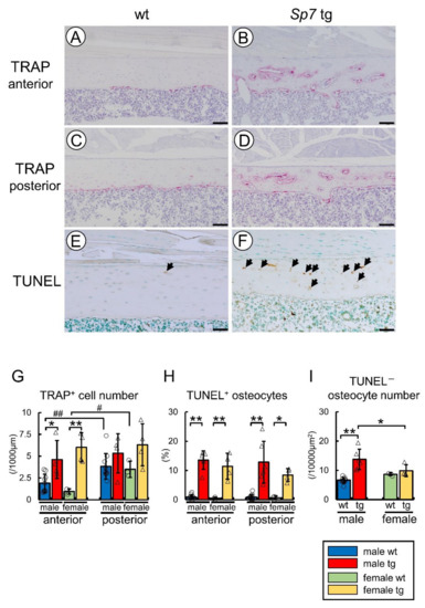 IJMS | Free Full-Text | Sp7 Transgenic Mice with a Markedly Impaired ...