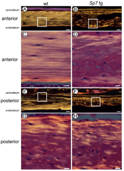 IJMS | Free Full-Text | Sp7 Transgenic Mice with a Markedly Impaired ...