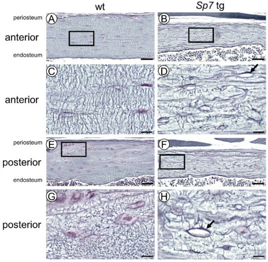 IJMS | Free Full-Text | Sp7 Transgenic Mice with a Markedly Impaired ...