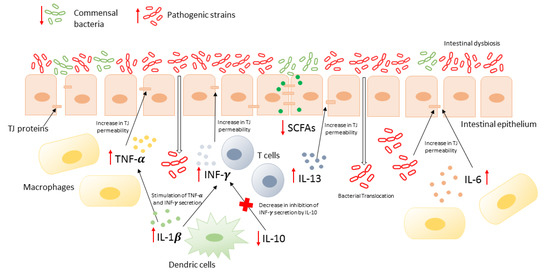 IJMS | Free Full-Text | Preventing Bacterial Translocation in Patients ...