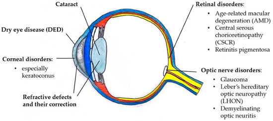 Sex Hormones and Their Effects on Ocular Disorders and Pathophysiology ...