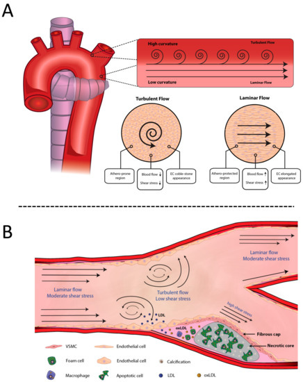 Pathophysiology of Atherosclerosis