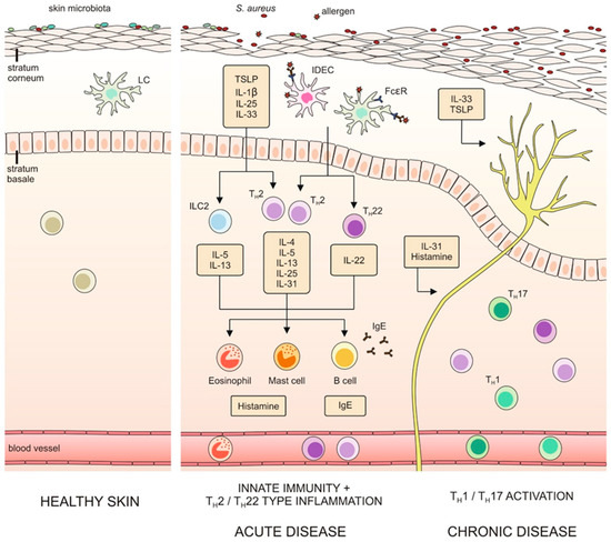 IJMS | Free Full-Text | Skin Microbiota in Atopic Dermatitis