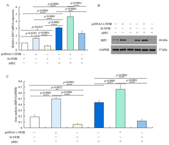 Transcriptional Regulation of RIP2 Gene by NFIB Is Associated with ...