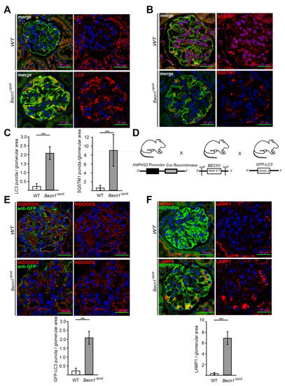 BECLIN1 Is Essential for Podocyte Secretory Pathways Mediating VEGF ...