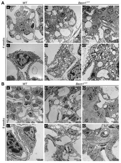 BECLIN1 Is Essential for Podocyte Secretory Pathways Mediating VEGF ...
