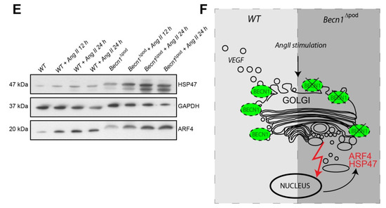 BECLIN1 Is Essential for Podocyte Secretory Pathways Mediating VEGF ...