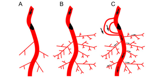 Interdependence of Angiogenesis and Arteriogenesis in Development and ...