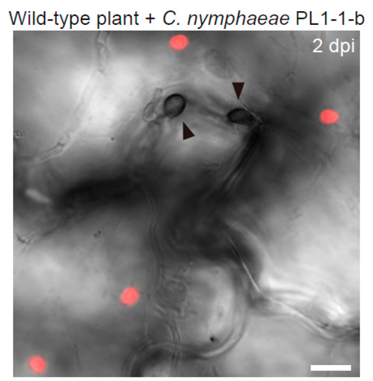 Emerging Roles of Motile Epidermal Chloroplasts in Plant Immunity