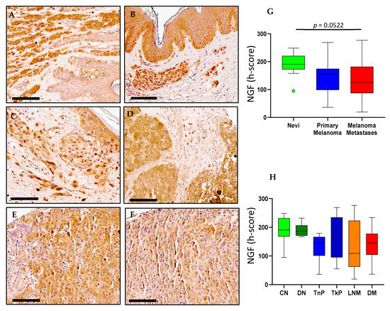 Expression of NGF/proNGF and Their Receptors TrkA, p75NTR and Sortilin ...
