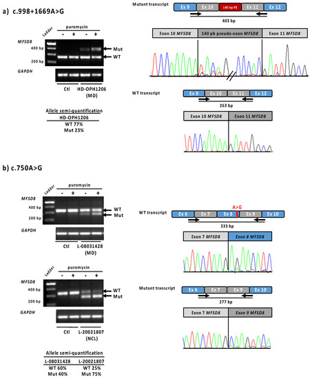 Contribution of Whole-Genome Sequencing and Transcript Analysis to ...