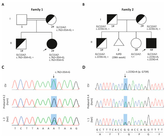 New Cases of Hypochromic Microcytic Anemia Due to Mutations in the ...