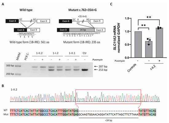 New Cases of Hypochromic Microcytic Anemia Due to Mutations in the ...