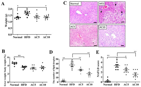 Acacetin Protects against Non-Alcoholic Fatty Liver Disease by ...