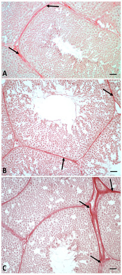 Molecular and Histological Effects of Glyphosate on Testicular Tissue ...