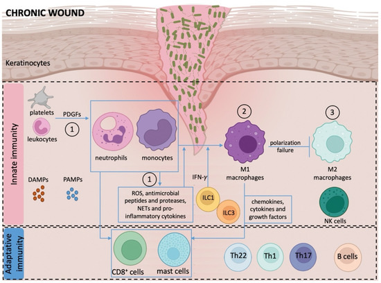 Chronic Inflammation in Non-Healing Skin Wounds and Promising Natural ...