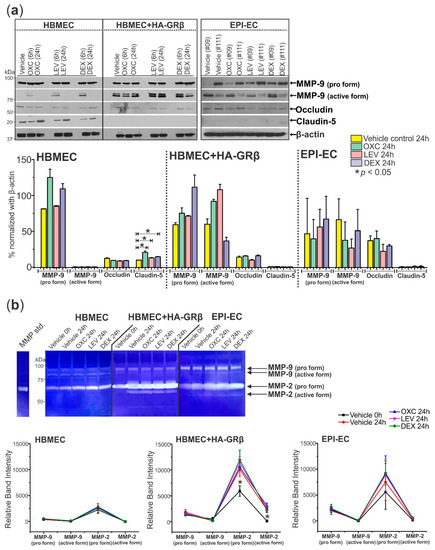 IJMS | Special Issue : Molecular and Cellular Mechanisms of Epilepsy