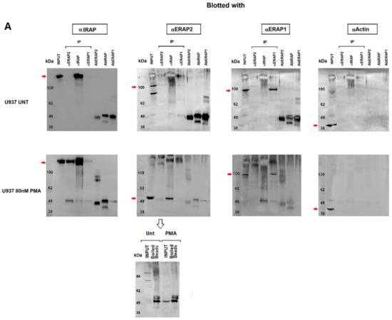 IJMS | Free Full-Text | A Short ERAP2 That Binds IRAP Is Expressed in Macrophages Independently ...