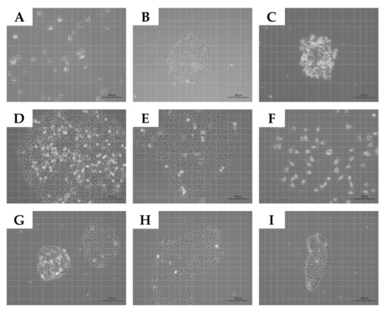 Elevated Expression of the Immune Checkpoint Ligand CD276 (B7-H3) in ...