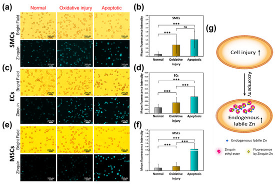 Reducing Endogenous Labile Zn May Help to Reduce Smooth Muscle Cell ...
