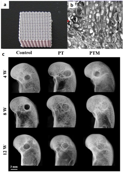 Application of 3D-Printed, PLGA-Based Scaffolds in Bone Tissue Engineering