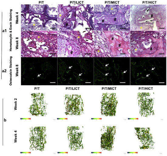 Application of 3D-Printed, PLGA-Based Scaffolds in Bone Tissue Engineering