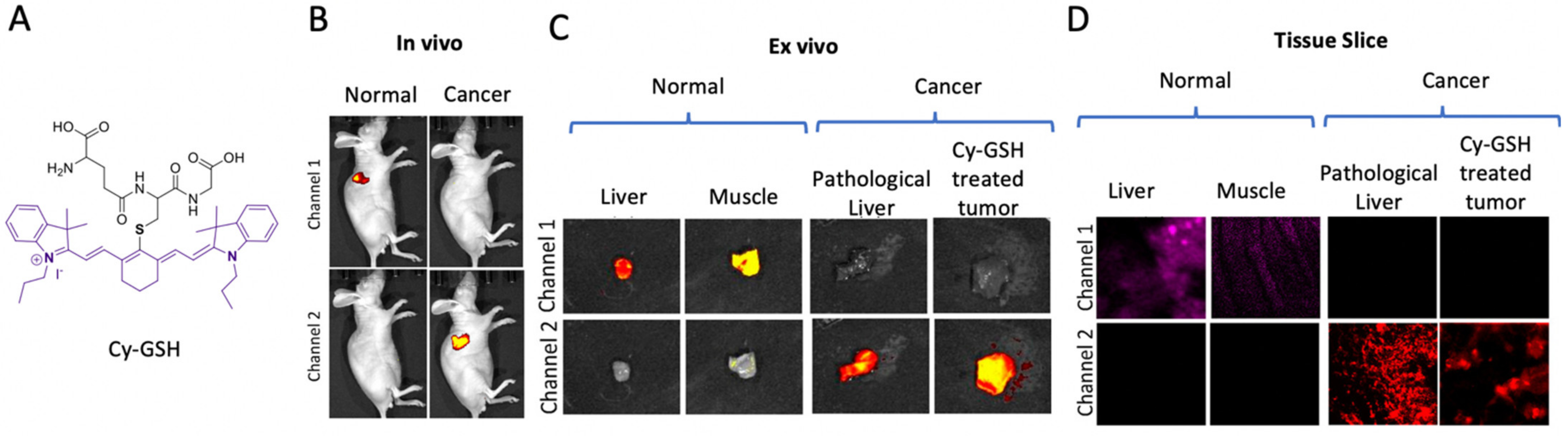 Chemical Probes and Activity-Based Protein Profiling for Cancer Research