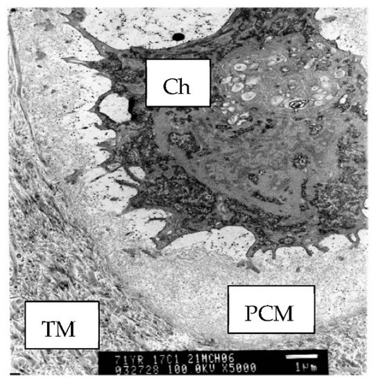 The Extracellular Matrix of Articular Cartilage Controls the ...