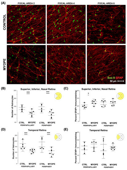 Myopia Alters the Structural Organization of the Retinal Vasculature ...