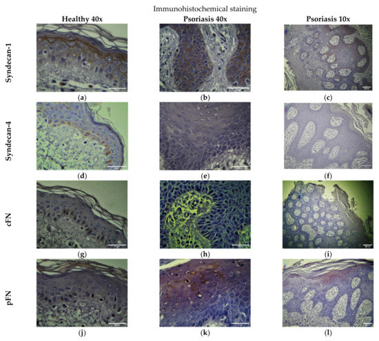 IJMS | Free Full-Text | Altered Distribution and Expression of Syndecan ...