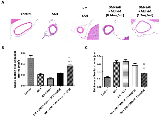 Therapeutic Effect of Mitochondrial Division Inhibitor-1 (Mdivi-1) on ...