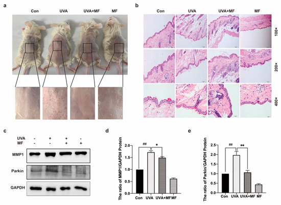 Metformin Attenuates UVA-Induced Skin Photoaging by Suppressing ...